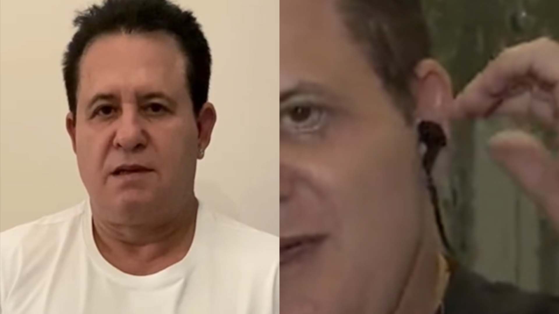 Cirurgia Plastica Antes E Depois Do Rosto O Que Lindsay Lohan Fez No