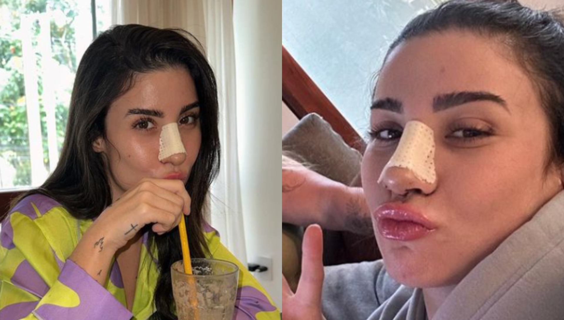 Bianca Andrade surge com curativo no nariz após refazer cirurgia ...