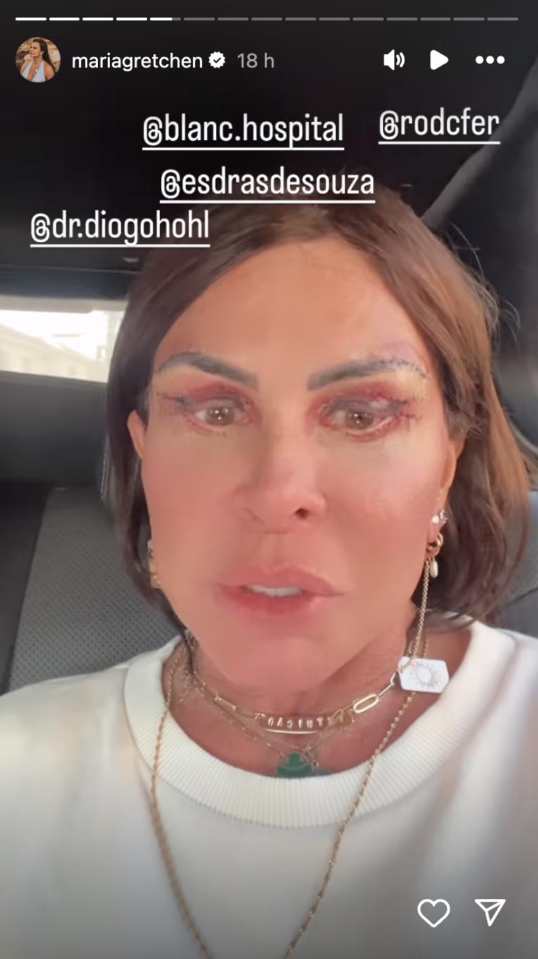 Gretchen surge com os olhos inchados e explica o que aconteceu - CARAS ...