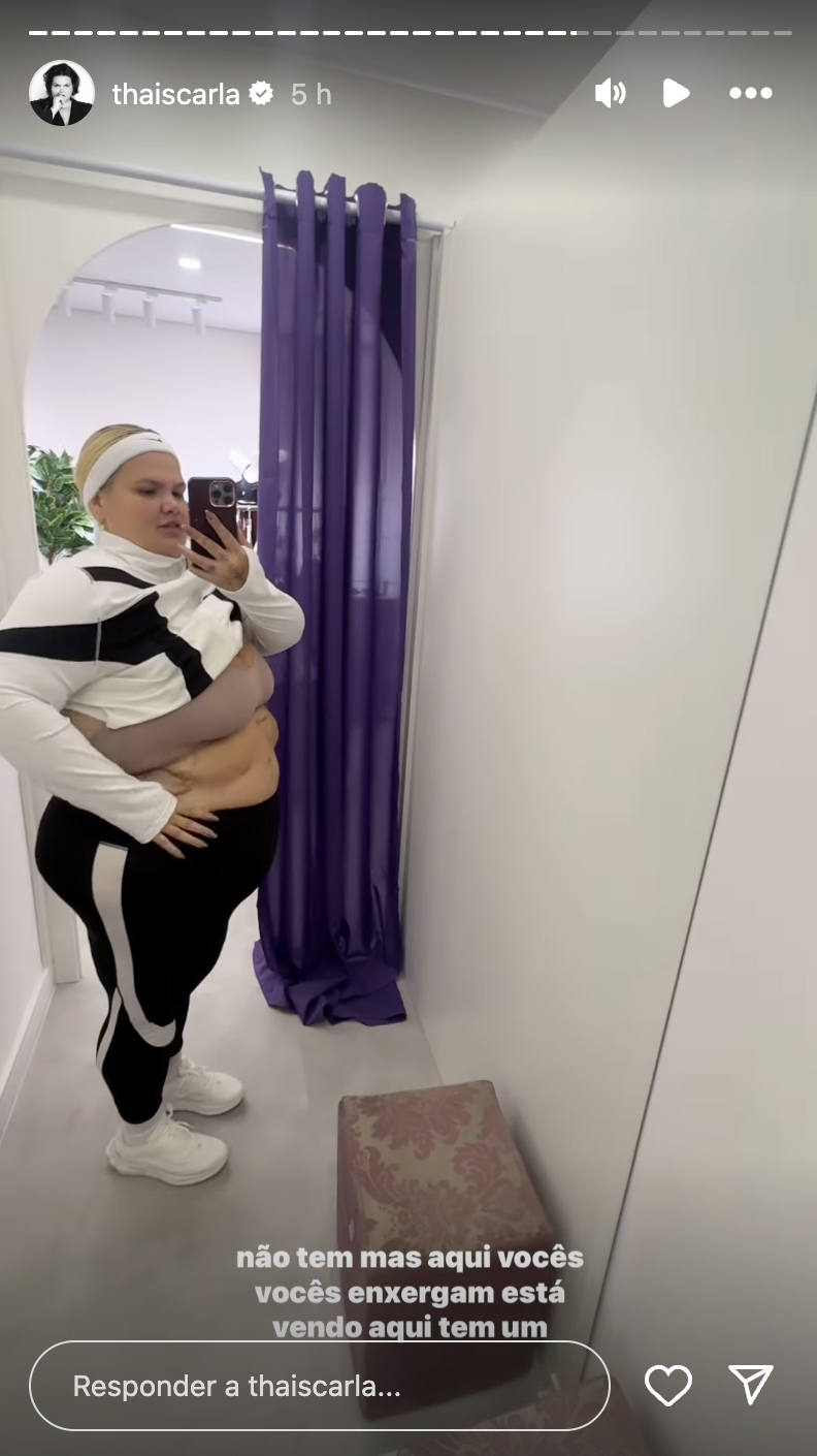 Thais Carla exibe sua barriga flácida após perder 50 kg - CARAS Brasil