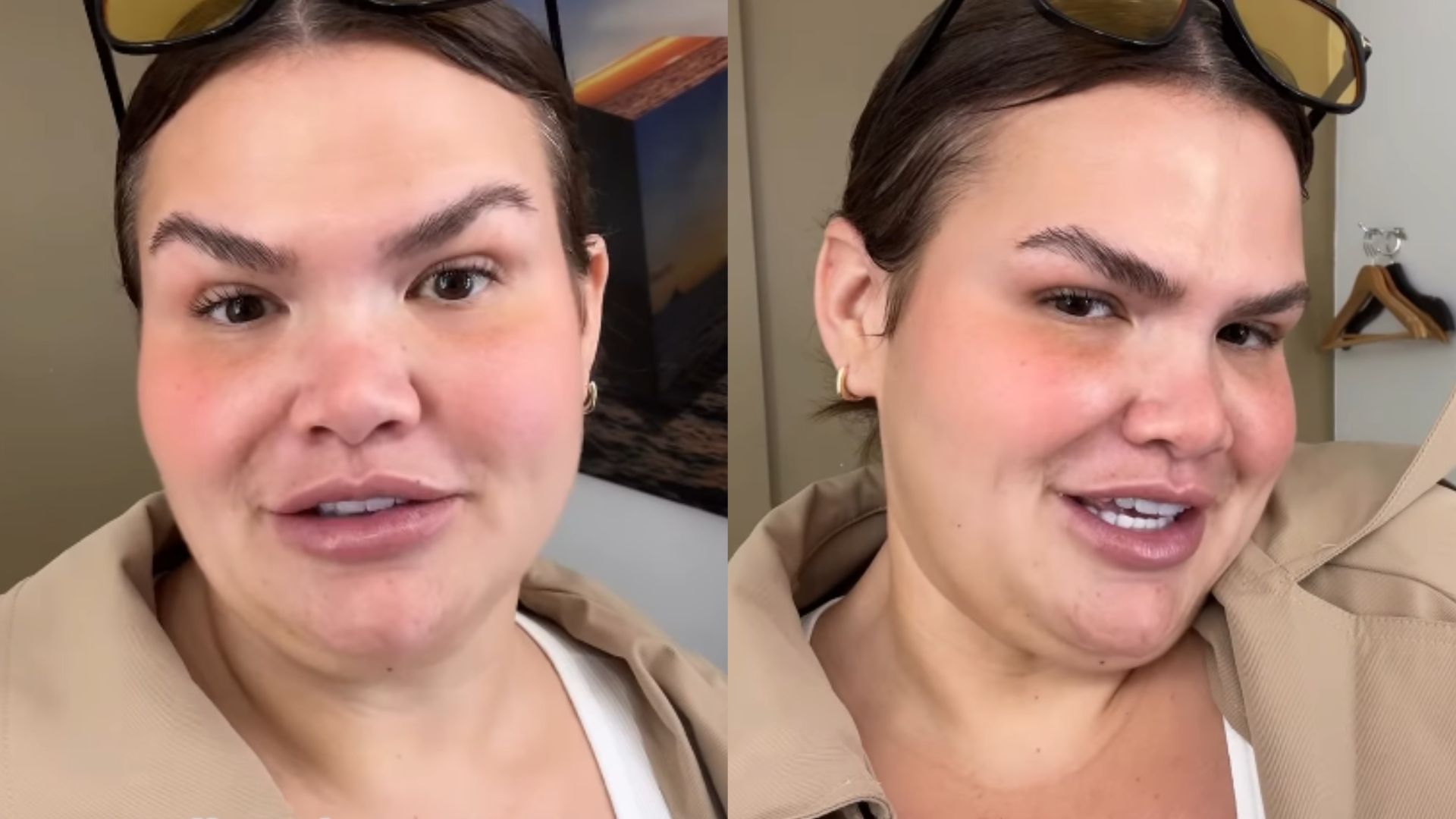 Thais Carla revela próxima cirurgia após a bariátrica: 'Nem eu vou me ...