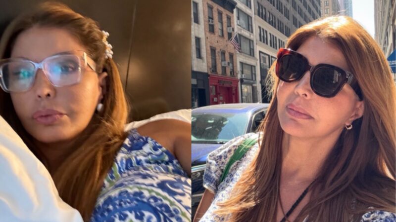 Roberta Close faz harmonização facial depois dos 60 anos - CARAS Brasil