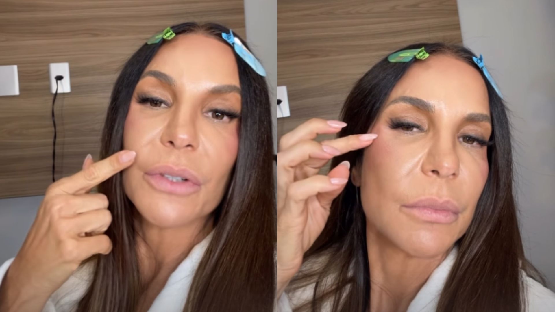 Ivete Sangalo fala sobre recuperação e atualiza estado de saúde - CARAS ...